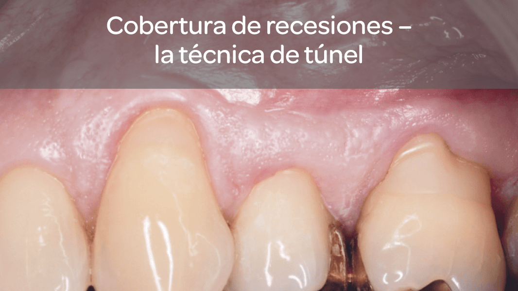 Matriz tisular reconstructiva NovoMatrix®