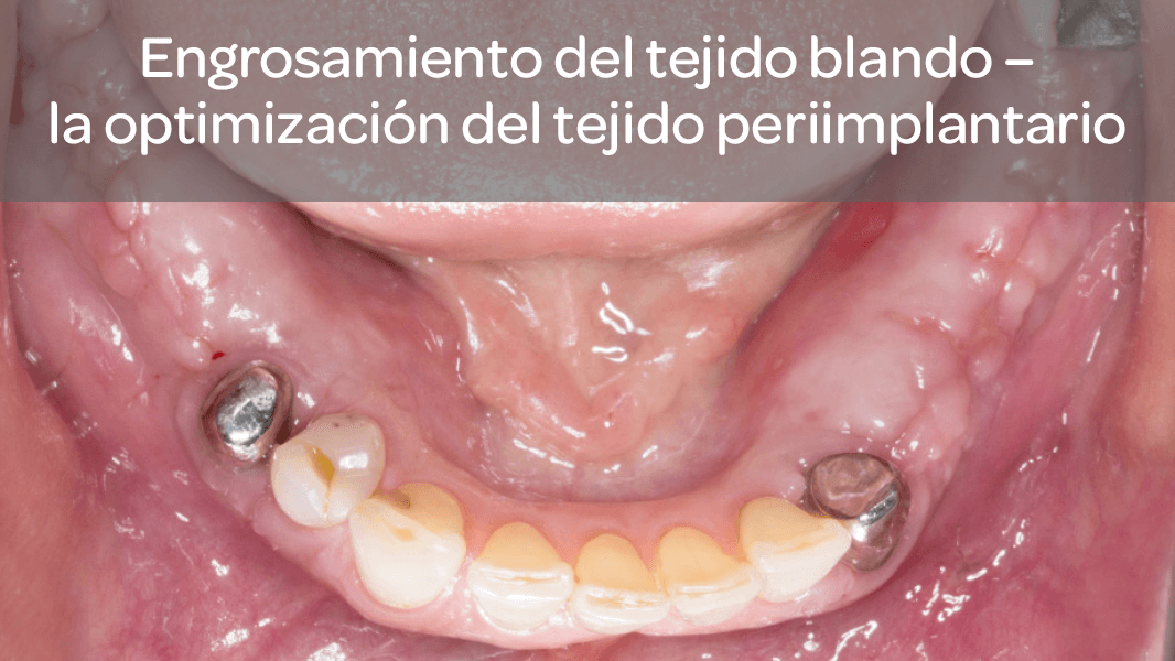 Matriz tisular reconstructiva NovoMatrix®