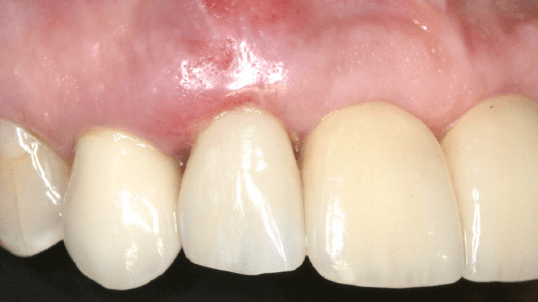 Matriz tisular reconstructiva NovoMatrix®