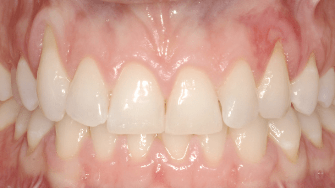 Matriz tisular reconstructiva NovoMatrix®