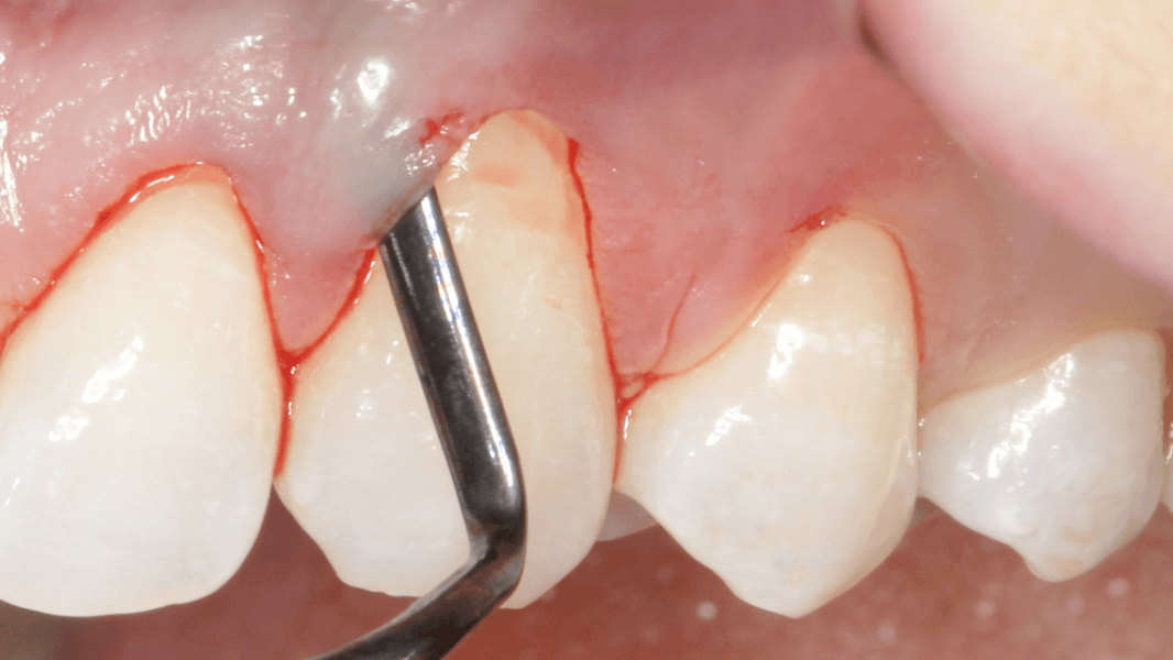 Matriz tisular reconstructiva NovoMatrix®