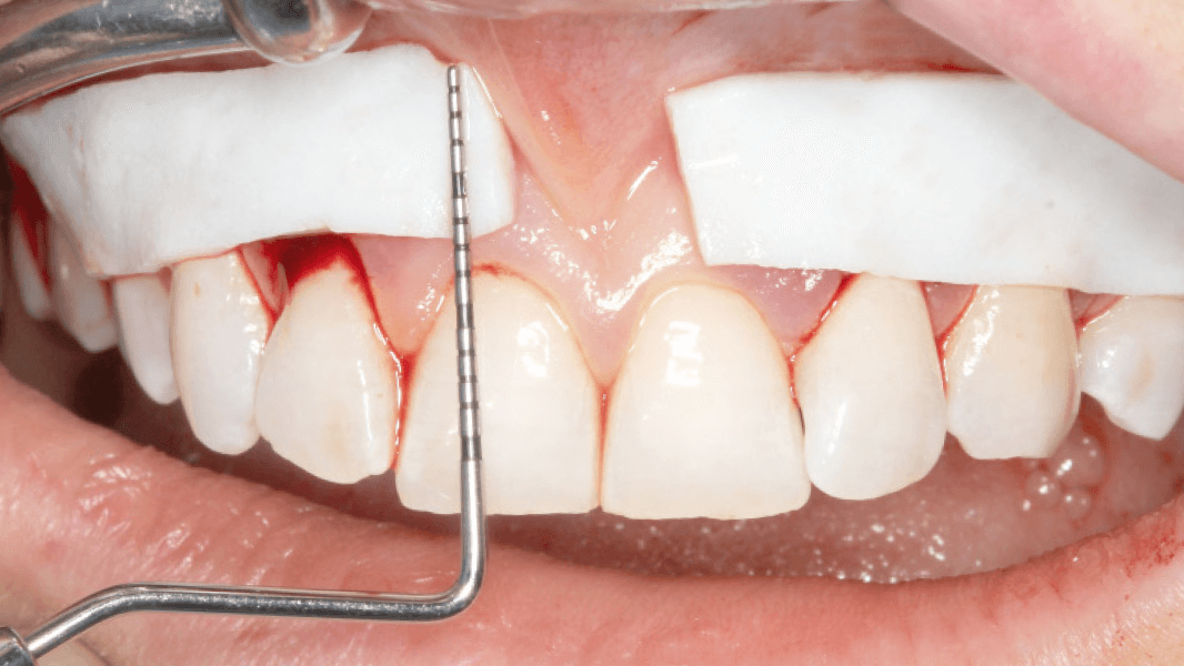 Matriz tisular reconstructiva NovoMatrix®