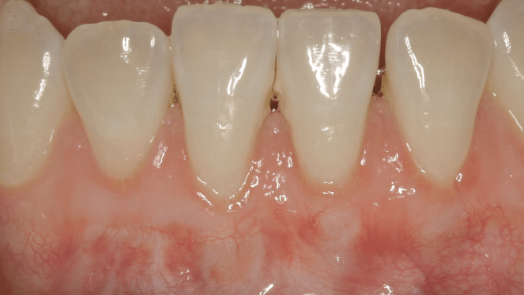 Matriz tisular reconstructiva NovoMatrix®