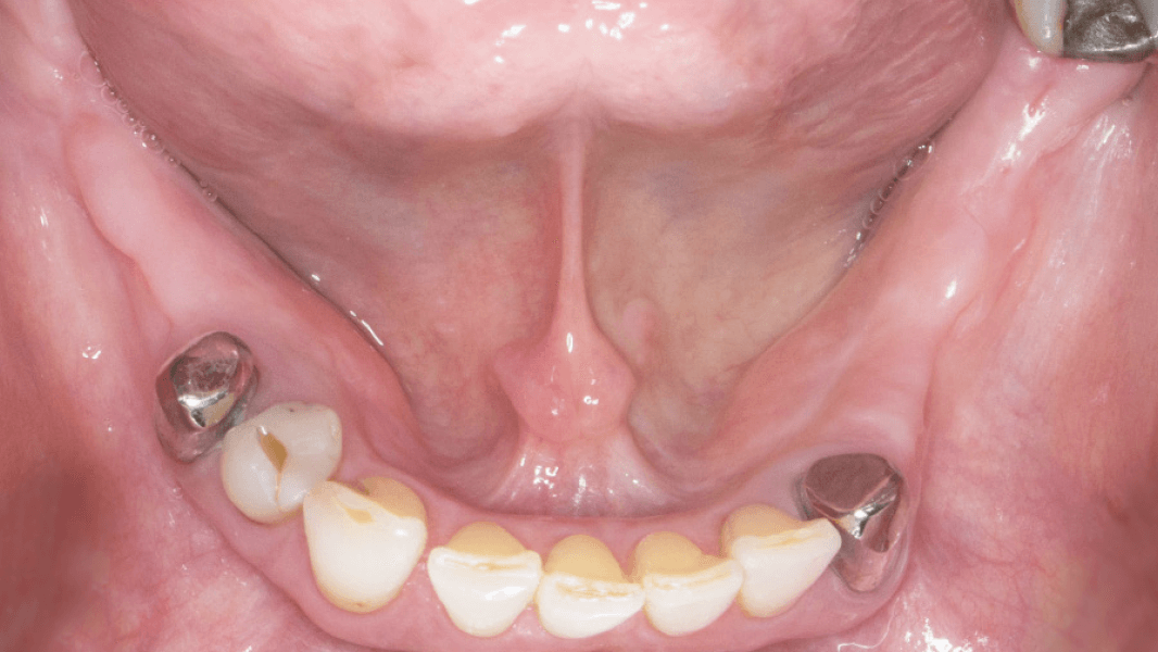 Matriz tisular reconstructiva NovoMatrix®